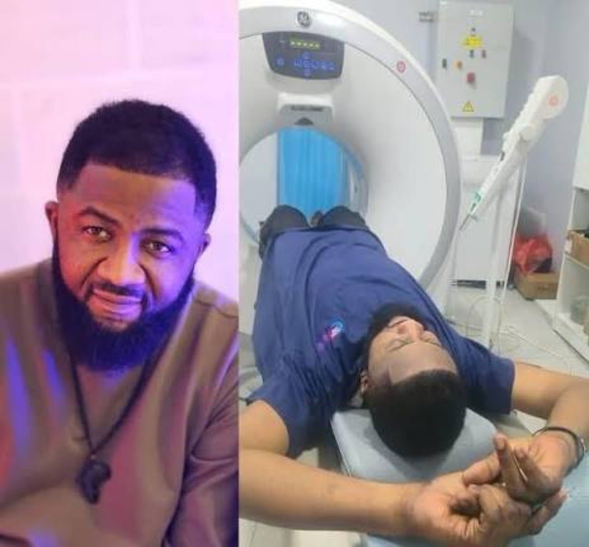 AGN confirms actor Benedict Johnson hospitalised, set for surgery ...